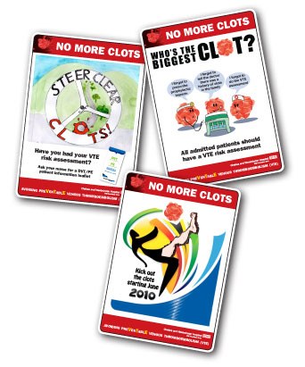 ‘No more clots’ campaign to prevent DVT — Chelsea and Westminster ...