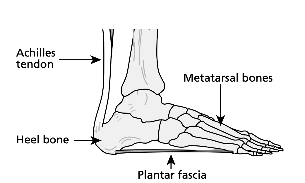 HeelPainSyndrome.png — Chelsea and Westminster Hospital NHS Foundation ...