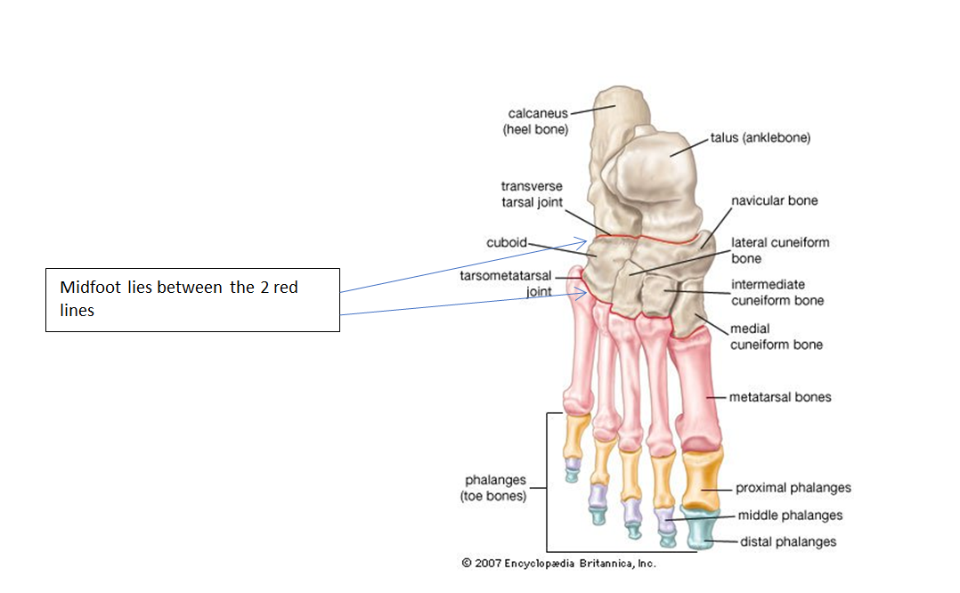 Midfootproblems.PNG — Chelsea and Westminster Hospital NHS Foundation Trust