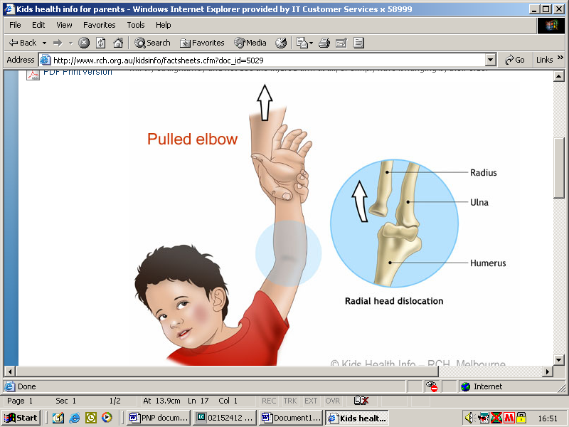 pulledelbow.png — Chelsea and Westminster Hospital NHS Foundation Trust